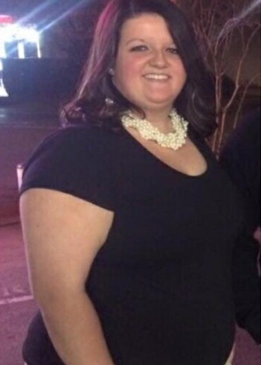 Kaycee’s Patient Story | TLC Surgery